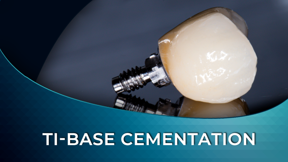 Implant Abutment Cementation Guide | Medit Australia: The Easy Entry ...